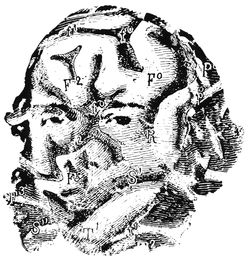 Pierre Paul Broca | Portraits of European Neuroscientists