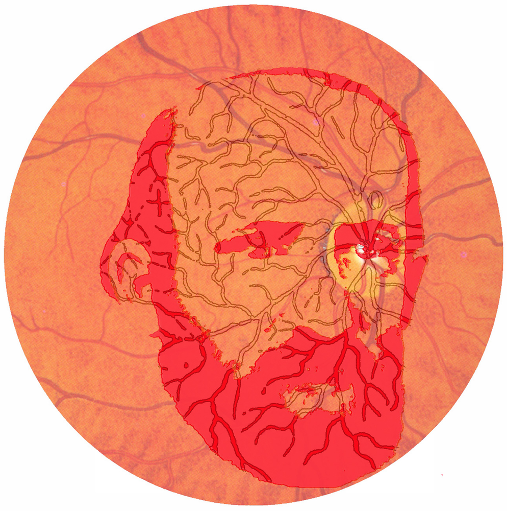 Heinrich Müller | Portraits of European Neuroscientists